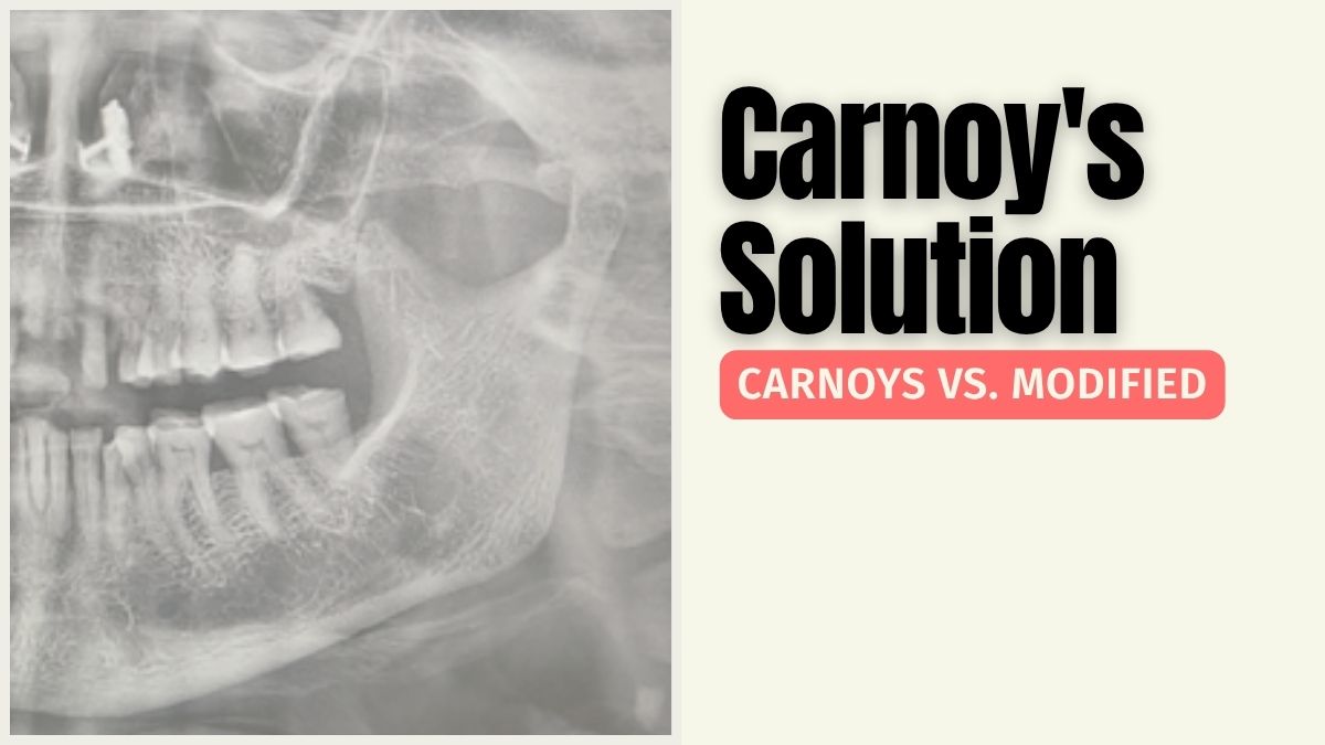 Carnoy's Vs. Modified Carnoy's in oral Surgery